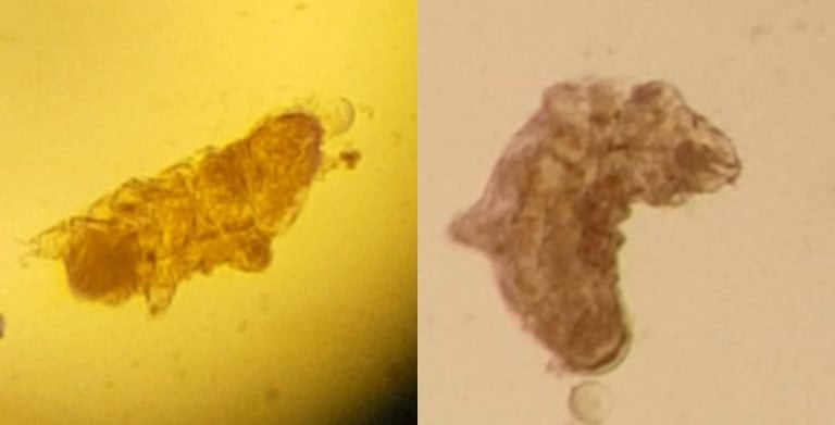 Space Bears – Lab-experience with Tardigrades – Moon Camp Challenge